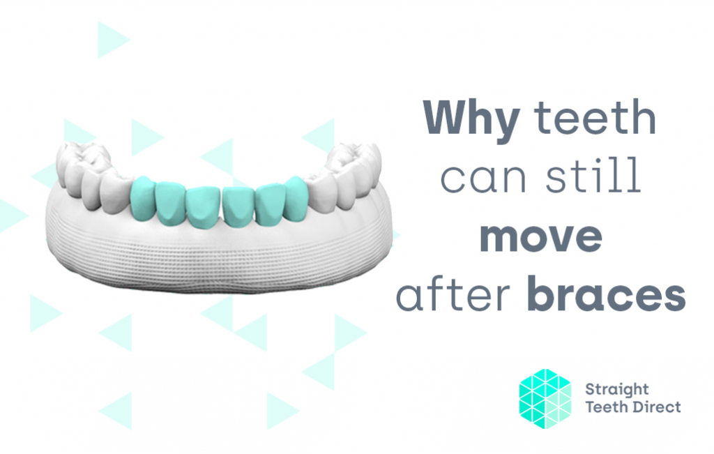 Why Teeth Move Even After Having Braces & How To Realign Them