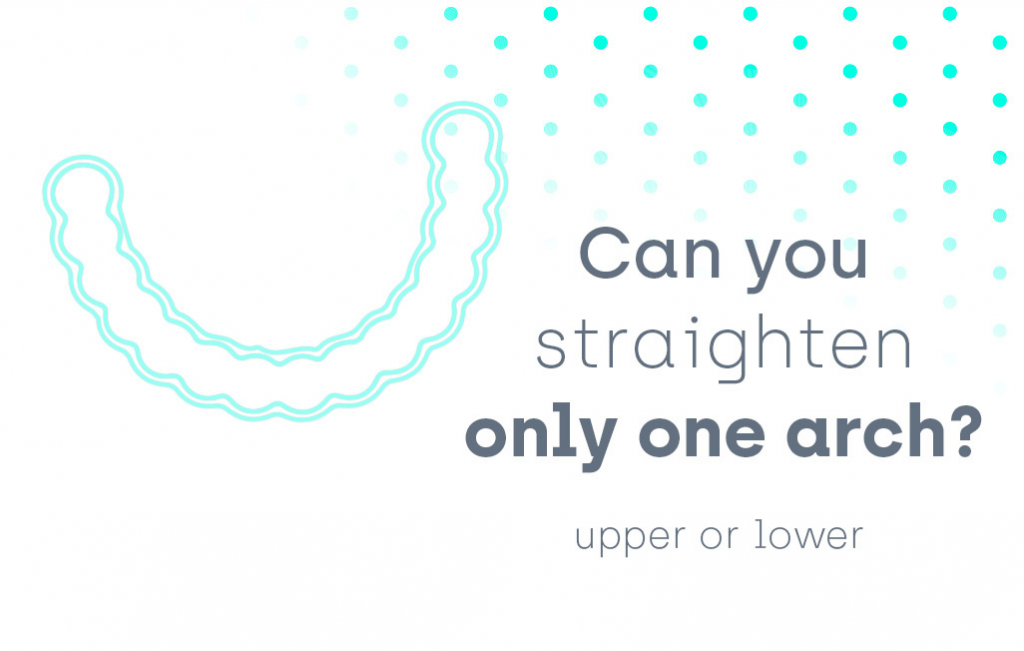 Single arch aligners: can I straighten one arch only?