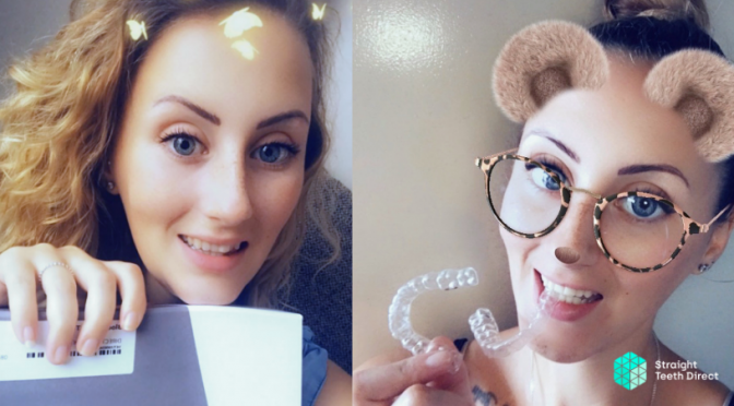 Aligners delivered direct to my door - Toni's straight teeth journey