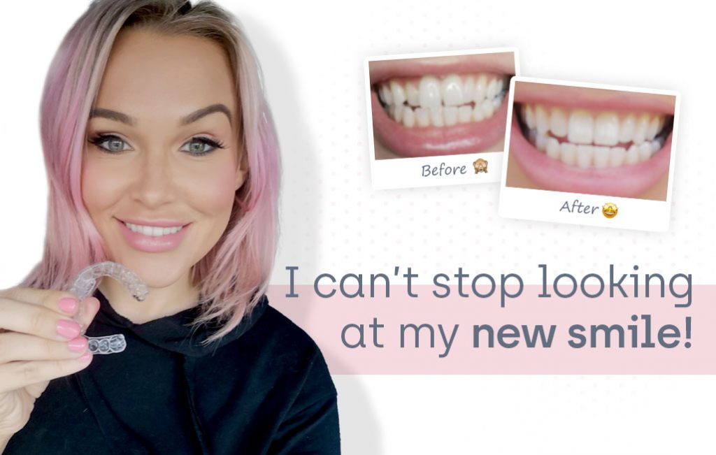 Blog - Straight Teeth Direct